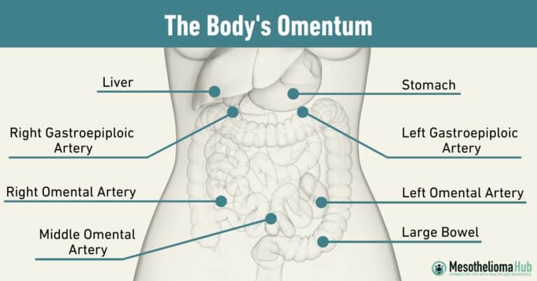 What Is an Omentectomy? - Mesothelioma Surgical Treatment